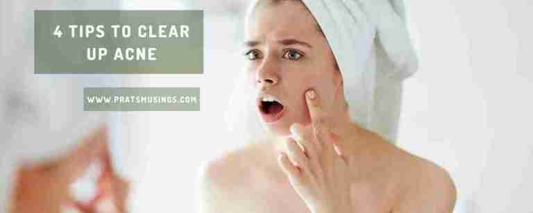 4 Tips to Clear up Acne
